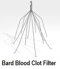 Missouri IVC Blood Clot Filter case filed